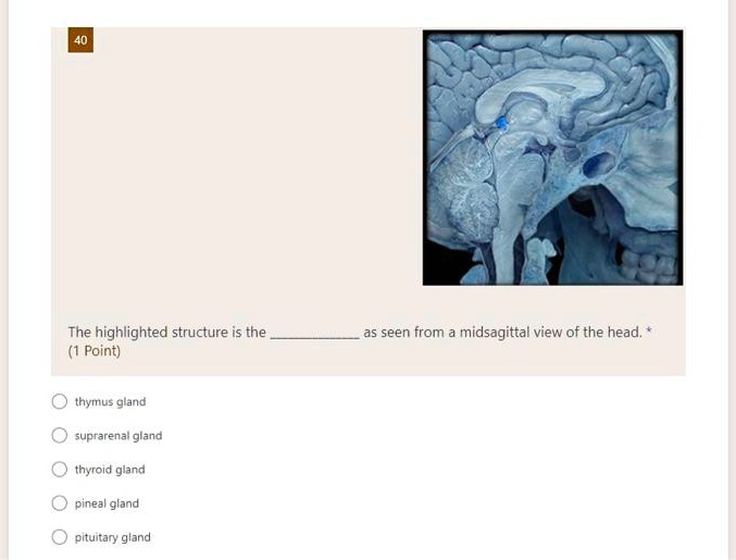 SOLVED: The highlighted structures are the: - Thymus gland - Suprarenal gland - Pineal gland ...