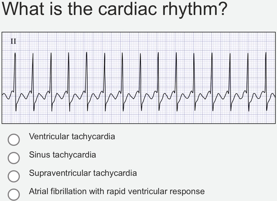 What is the Cardiac Rhythm shown in the EKG Strip? Choose from the ...