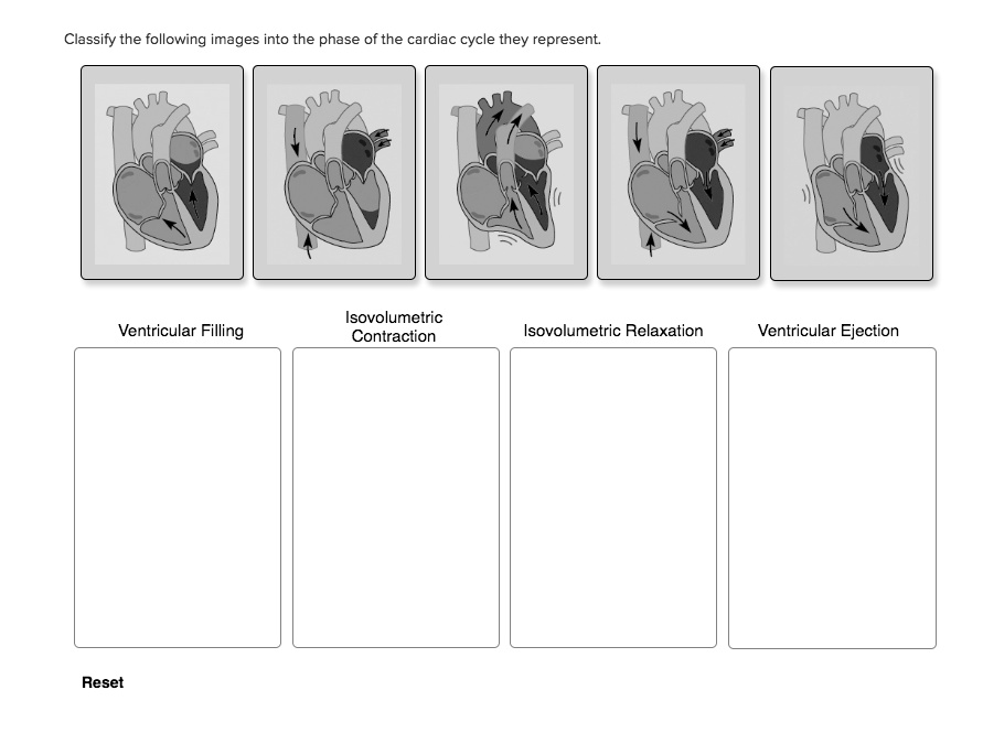 Classify the following images into the phase of the cardiac cycle they ...