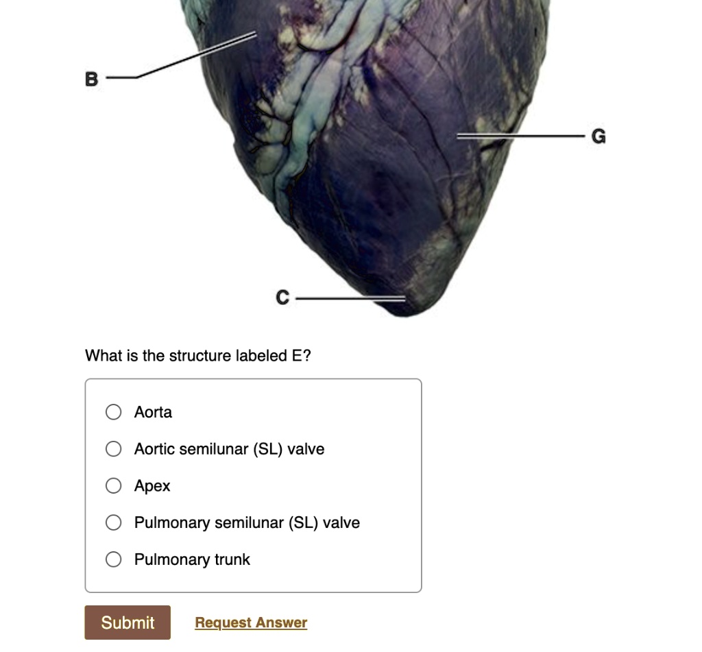 SOLVED: 0 G What is the structure labeled E? Aorta Aortic semilunar (SL ...