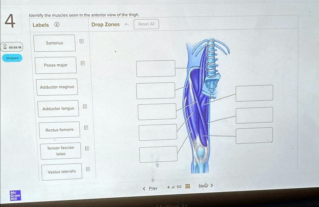 4 identify the muscles seen in the anterior view of the thigh labels i ...