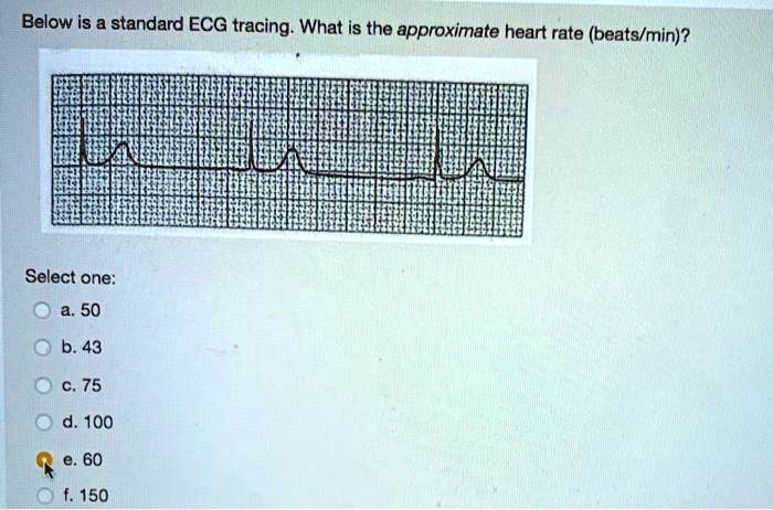 SOLVED: Below is a standard ECG tracing: What is the approximate heart ...