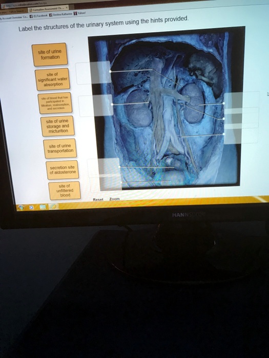 Label the structures of the urinary system using the hints provided ...