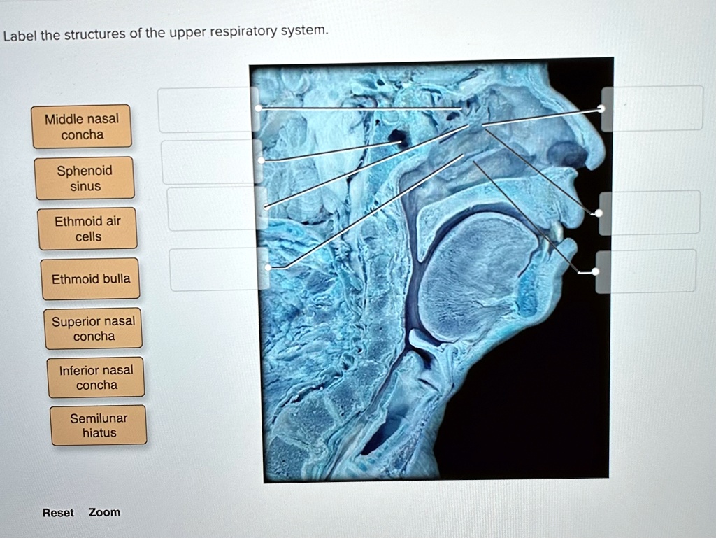 label the structures of the upper respiratory system middle nasal concha sphenoid sinus ethmoid ...
