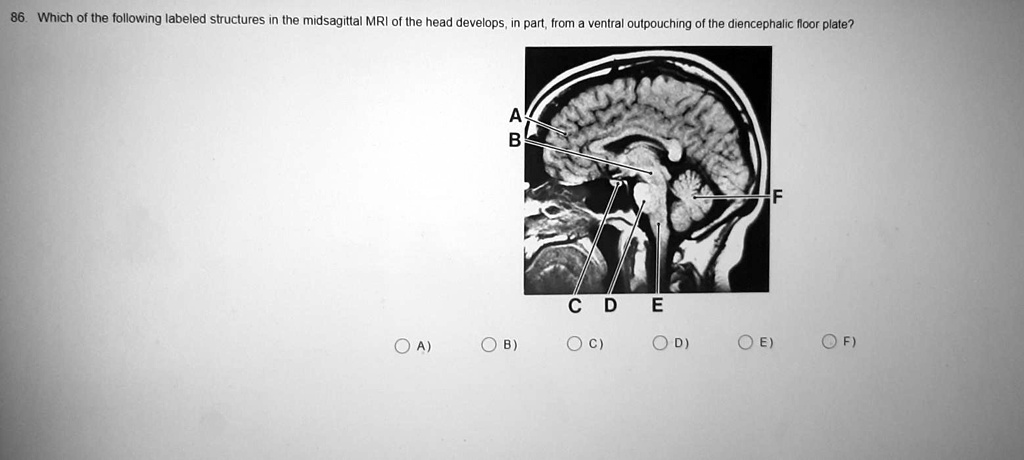 86. Which of the following labeled structures in the midsagittal MRI of ...