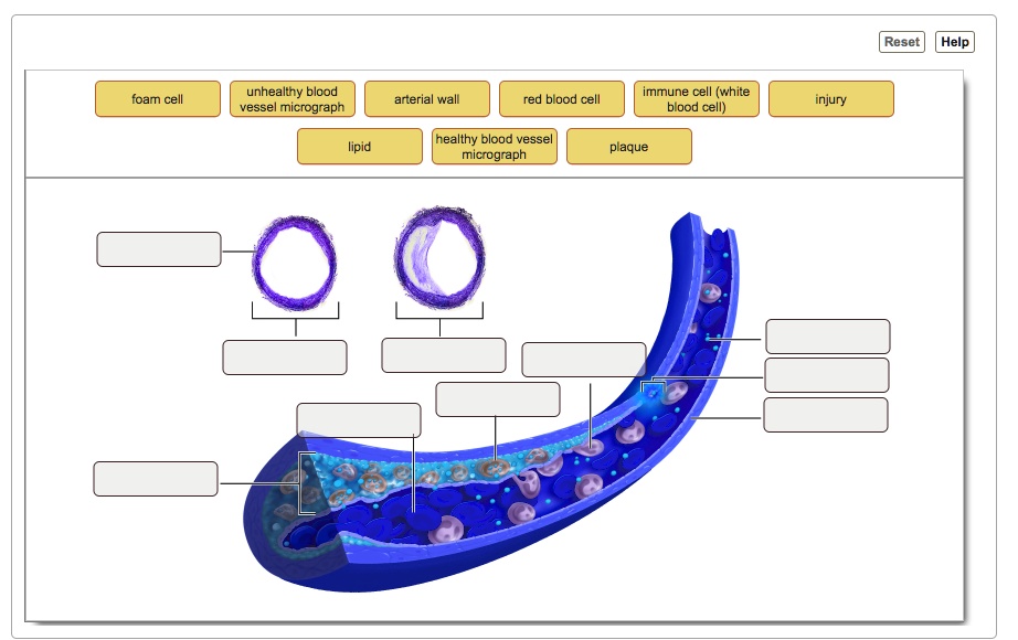 SOLVED: Reset unhealtny blood vesse micrograpn immune cell (white blood ...