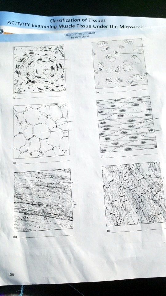 label the tissue type illustrated here and identify all structures ...