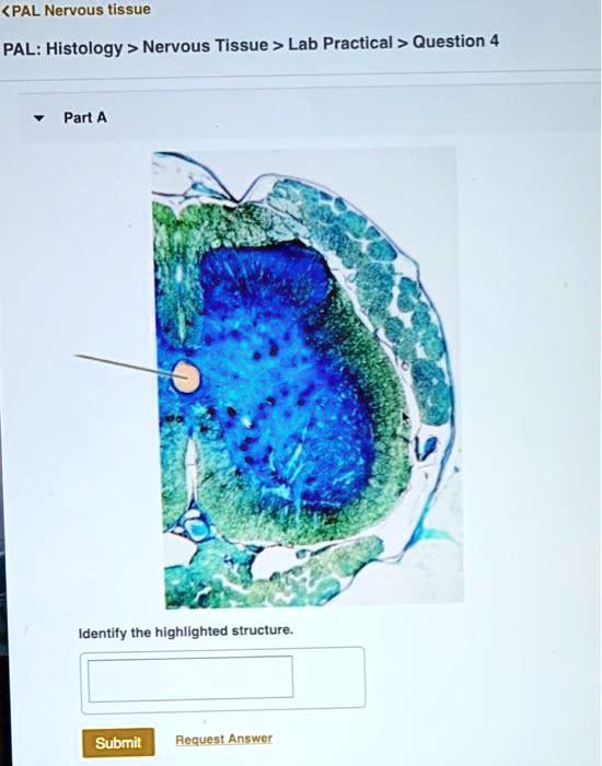 Nervous Tissue > Lab Practical > Question 4 Part A Identify the ...