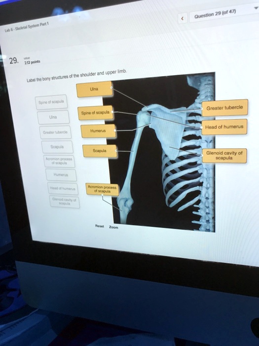 SOLVED: Lab 6 - Skeletal System Part 1 29. 2.2 points Label the bony structures of the shoulder ...