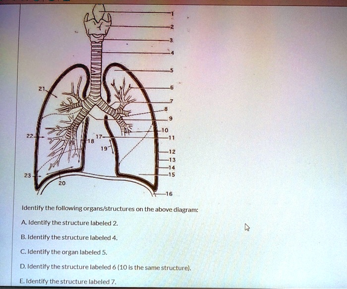 SOLVED: Identify the following organs/structures on the above diagram: A. Identify the structure ...