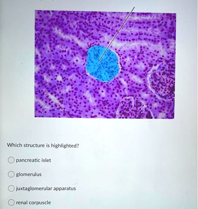 SOLVED: Which structure is highlighted? Pancreatic islet Glomerulus ...