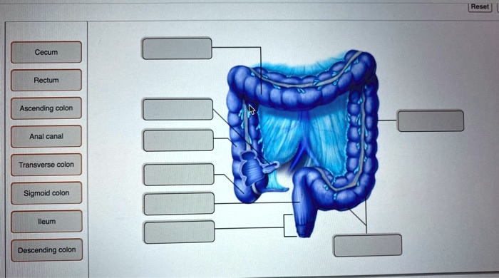 Cecum Rectum Ascending colon Anal canal Transverse colon Sigmoid colon ...