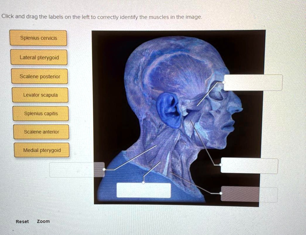 Click and drag the labels on the left to correctly identify the muscles ...