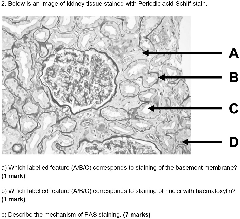 question 2 2 below is an image of kidney tissue stained with periodic ...