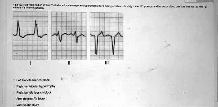 SOLVED: What is his likely diagnosis? Left bundle branch block Right ...