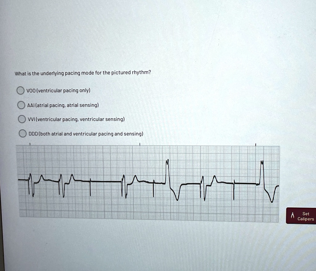 What is the underlying pacing mode for the pictured rhythm? VOO ...