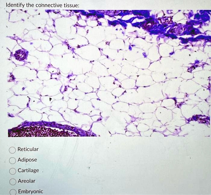 SOLVED: Identify the connective tissue: Reticular Adipose Cartilage ...