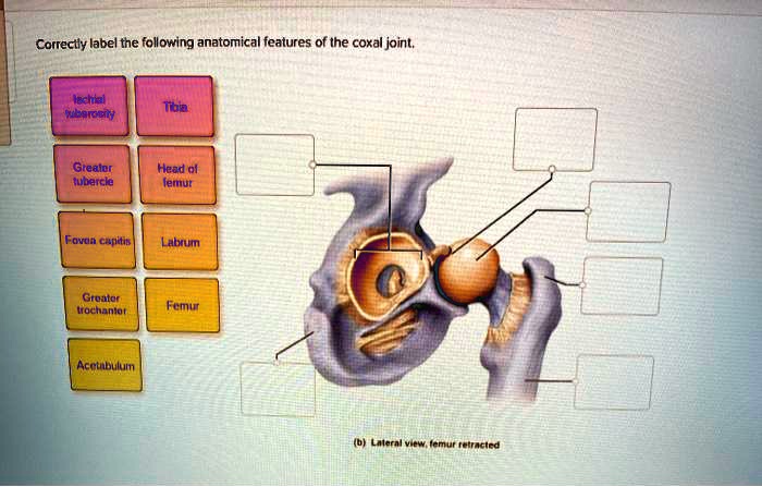 Correctly label the following anatomical features of the coxal joint ...