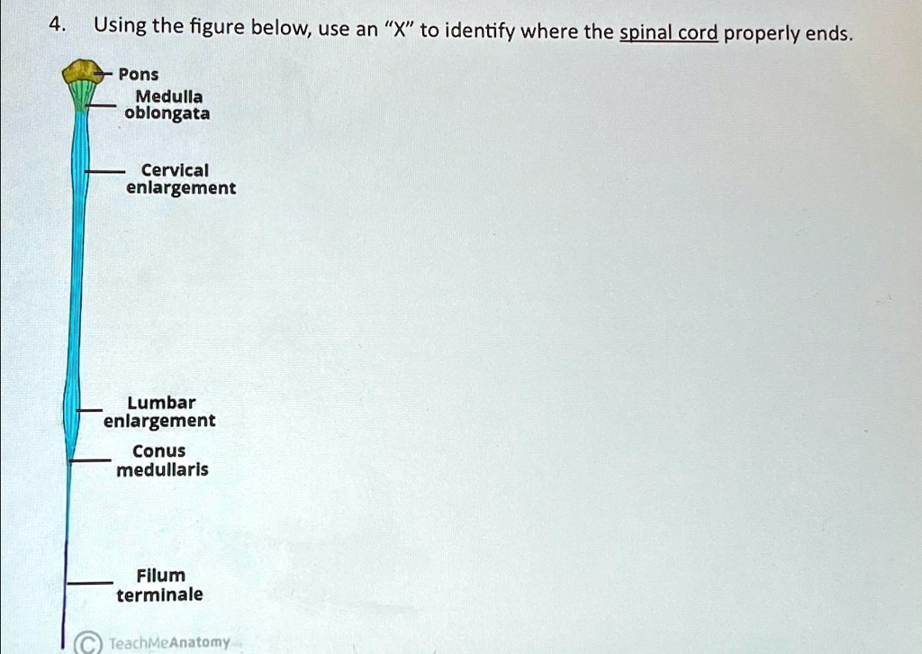 SOLVED: Using the figure below, use an "x" to identify where the spinal ...