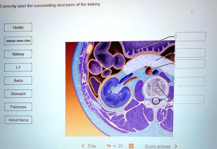 SOLVED: Correctly label the surrounding structures of the kidney ... SOLVED: Correctly label the surrounding structures of the kidney ...