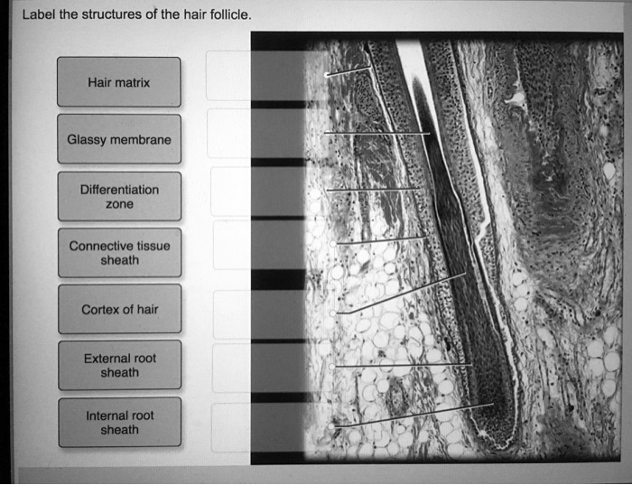 label the structures of the hair follicle hair matrix glassy membrane ...