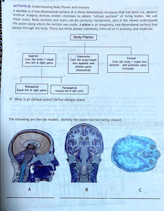SOLVED: ACTIVITY 8: Understanding Body Planes and Sections A section is ...