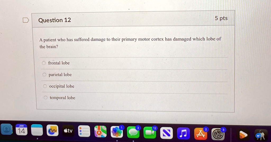 SOLVED: Question 12 5 pts A patient who has suffered damage to their ... SOLVED: Question 12 5 pts A patient who has suffered damage to their ...