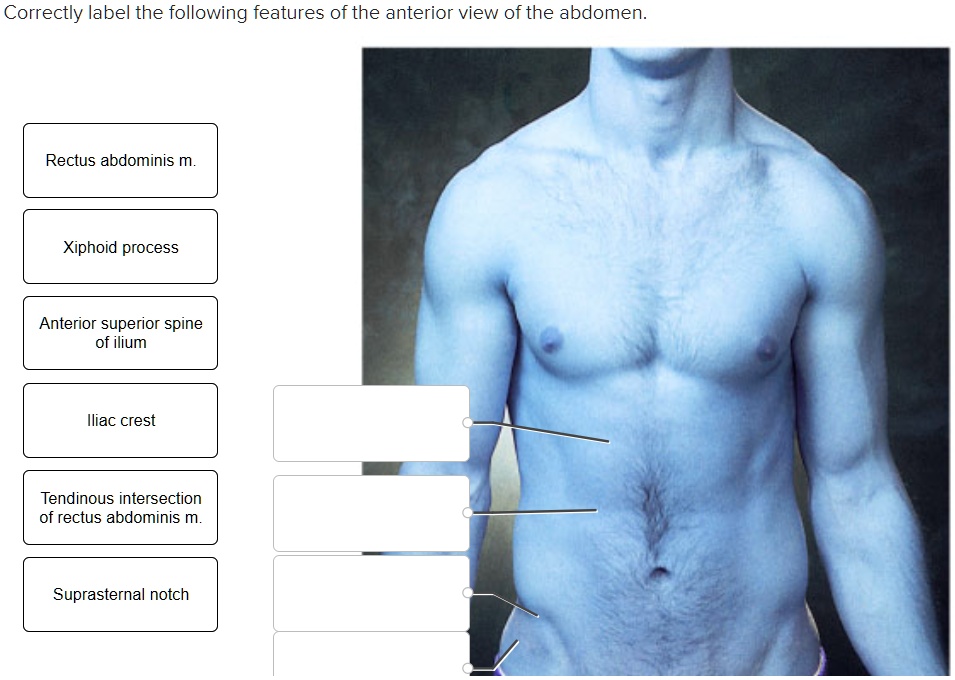SOLVED: Correctly label the following features of the anterior view of ... SOLVED: Correctly label the following features of the anterior view of ...