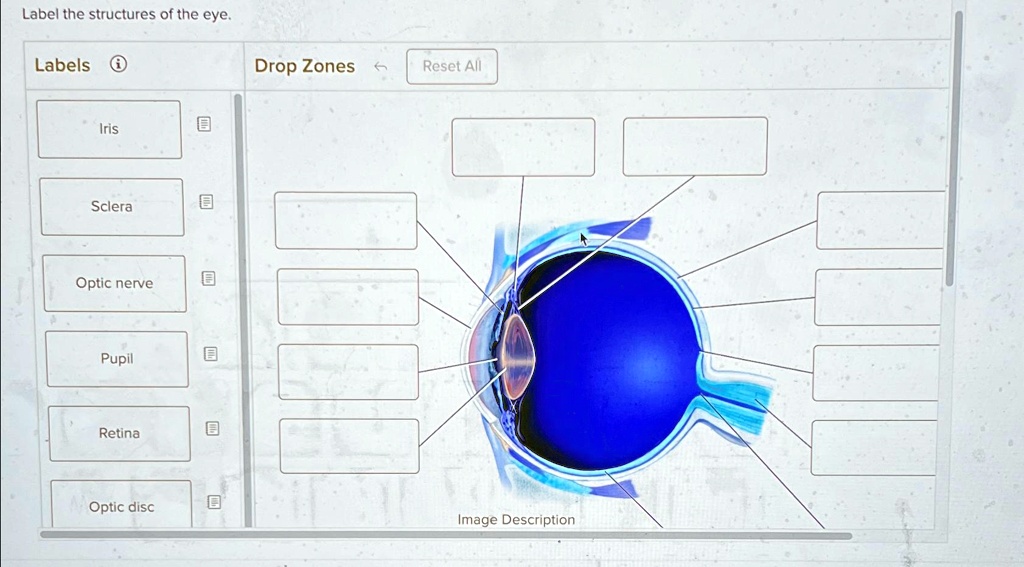 SOLVED: Label the structures of the eye. Labels (i) Drop Zones Reset All Label the structures of ...
