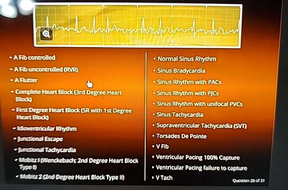 afib controlled a fib uncontrolled rvr aplimer complete heart block 3rd ...