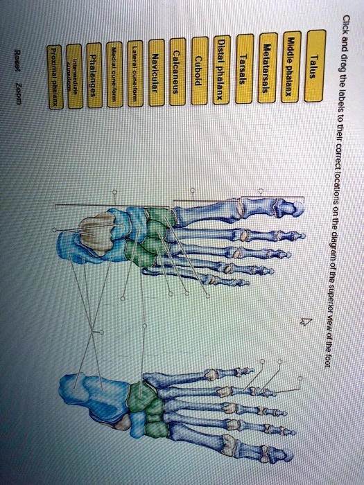 SOLVED: Proximal phalanx, Interphalangeal, Medial cuneiform, Lateral ...