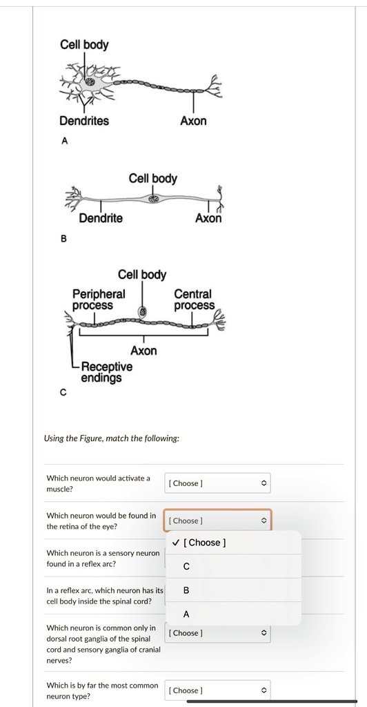Solved Cell Body Dendrites Axon Cell Body Dendrite Axon Cell Body
