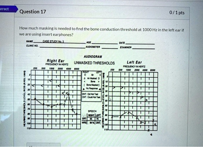 rrect question 17 01pts how much masking needed to find the bone ...