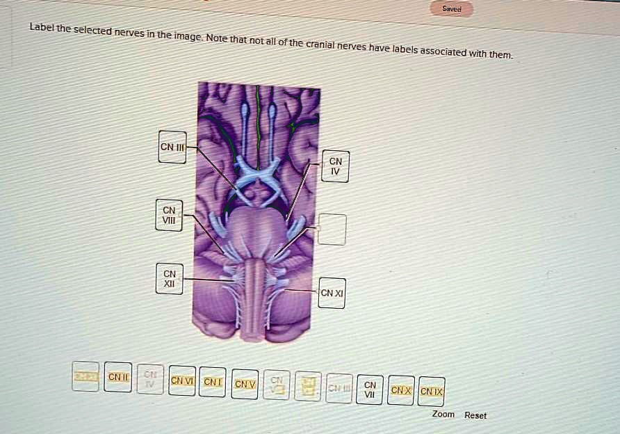 SOLVED: PaNES: Label the selected nerves in the image. Note that not ...