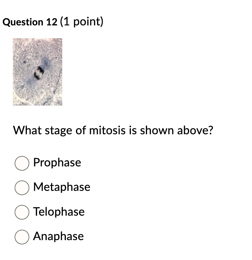 Question 12 (1 point) What stage of mitosis is shown above? Prophase ...