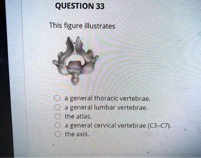 SOLVED: This figure illustrates a general thoracic vertebrae, a general ...
