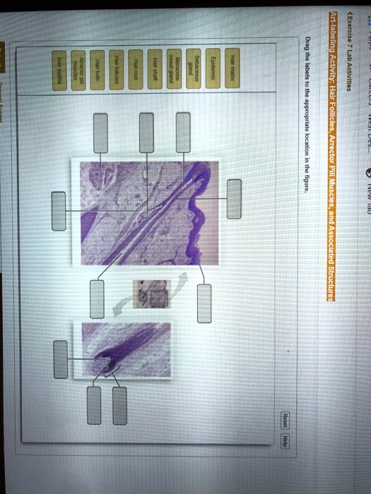 SOLVED: Art-Labeling Activity: Hair Follicles and Arrector Muscles