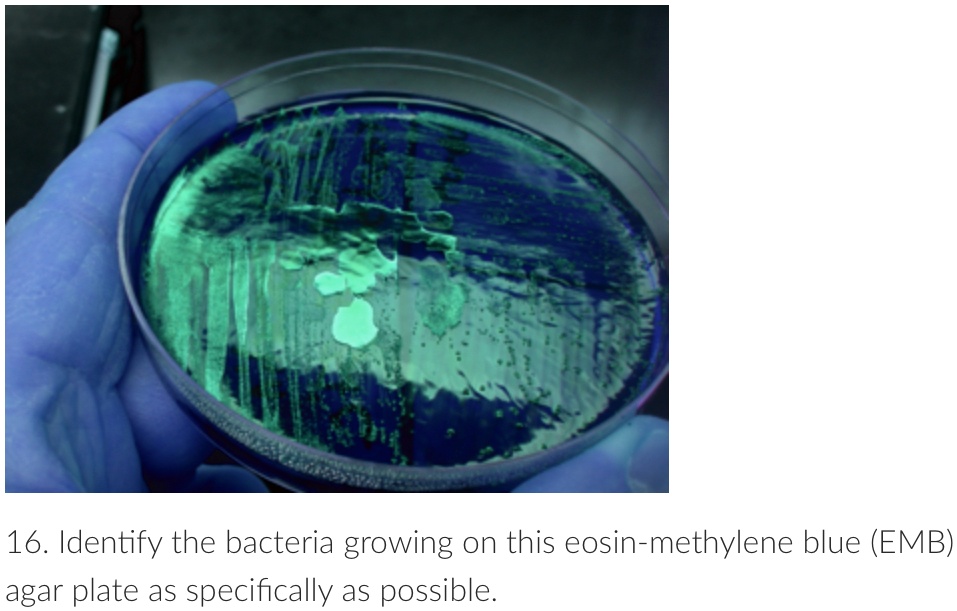 16. Identify the bacteria growing on this eosin-methylene blue (EMB ...