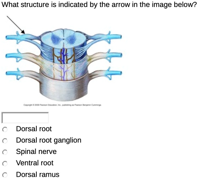 'What structure is indicated by the arrow in the image below? Dorsal root Dorsal root ganglion ...