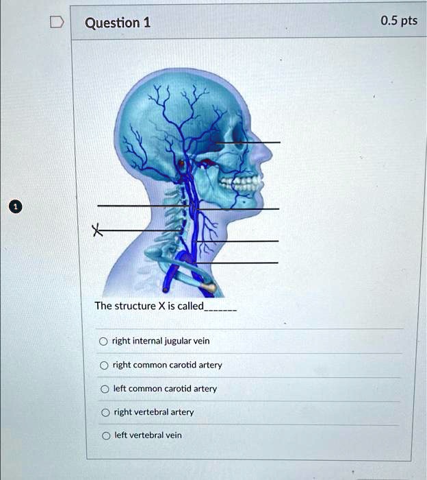 SOLVED: The structure X is called: - right internal jugular vein ...