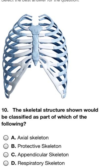 SOLVED: S)ed 10. The skeletal structure shown would be classified as ...