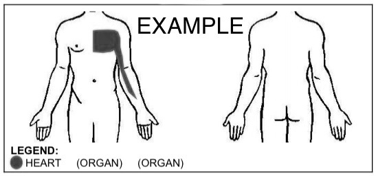 EXAMPLE LEGEND: HEART (ORGAN) (ORGAN)
