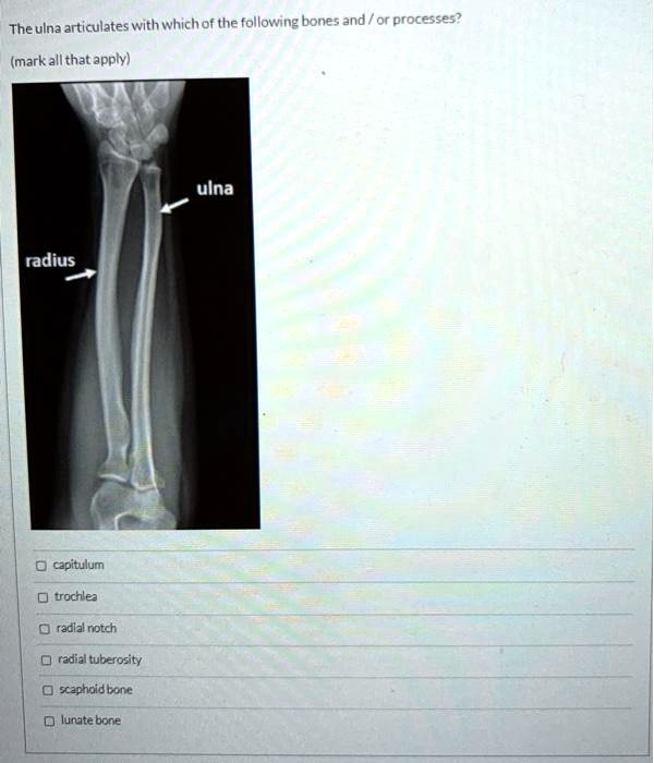 SOLVED: The ulna articulates with which of the following bones and ... SOLVED: The ulna articulates with which of the following bones and ...