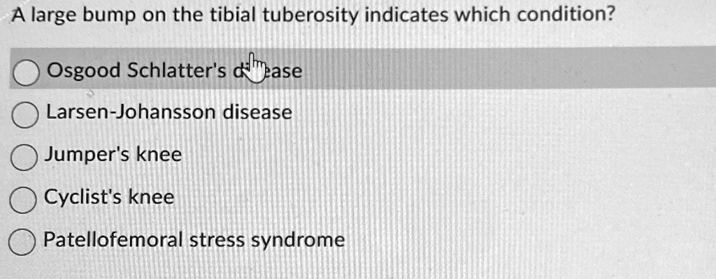 A large bump on the tibial tuberosity indicates which condition? Osgood ...