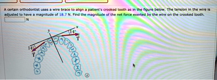 certain orthodontist uses wire brace to align patients crookcd tooth as ... certain orthodontist uses wire brace to align patients crookcd tooth as ...
