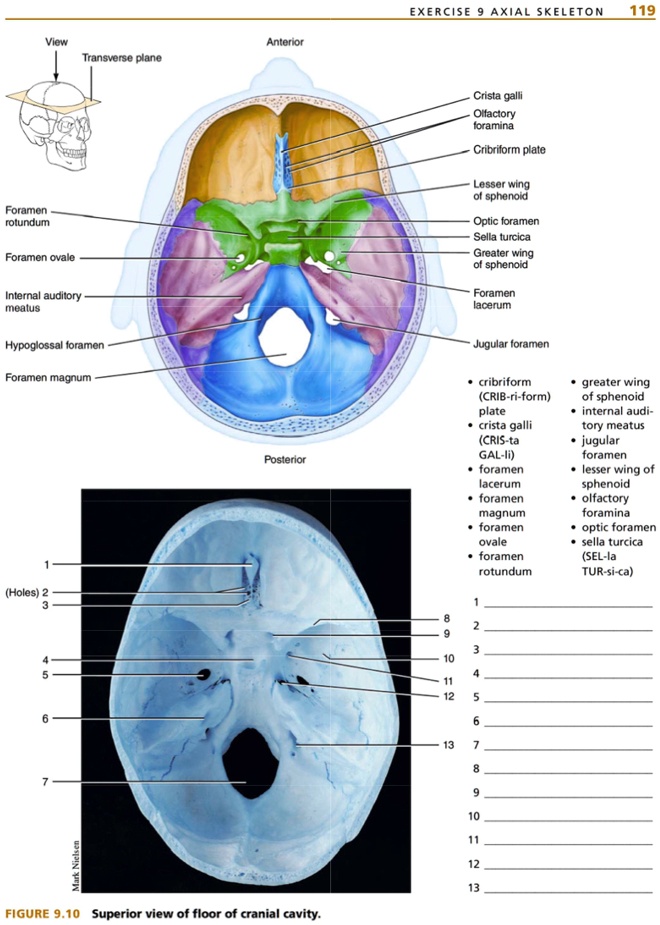 EXERCISE 9 AXIAL SKELETON 119 View Anterior Transverse plane Foramen ...