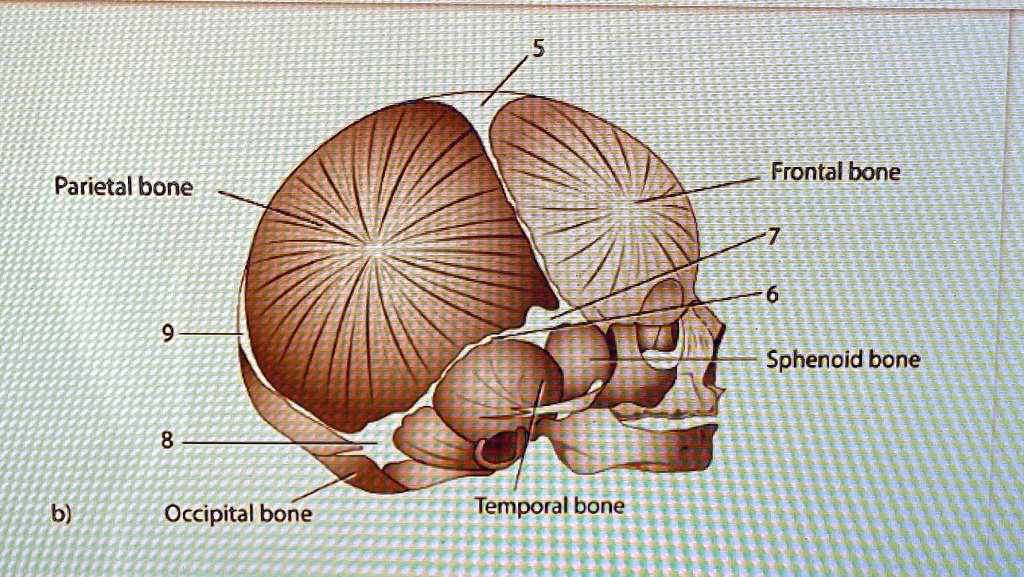 SOLVED: 'Frontal bone Parietal bone Sphenoid bone b) Occipital bone ...