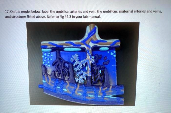 17. On the model below, label the umbilical arteries and vein, the ...