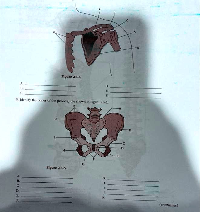 Figure 21-4 B. D. C. F. 5. Identify the bones of the pelvic girdle shown in Figure 21-5. Figure ...