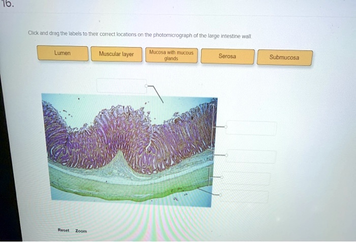 VIDEO solution: Click and drag the labels to their correct locations on ...